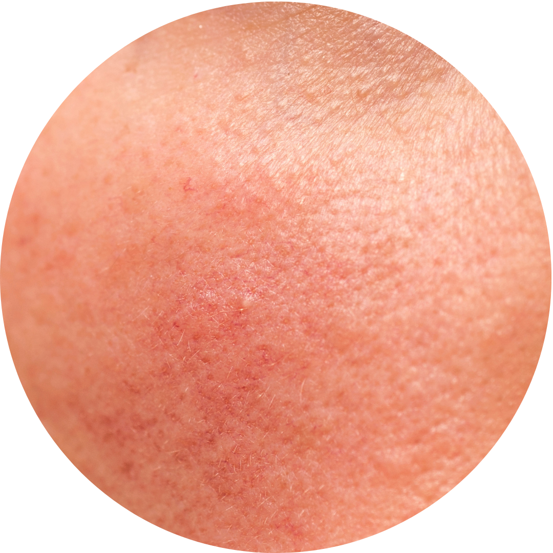 Anwendungen | DermoScan