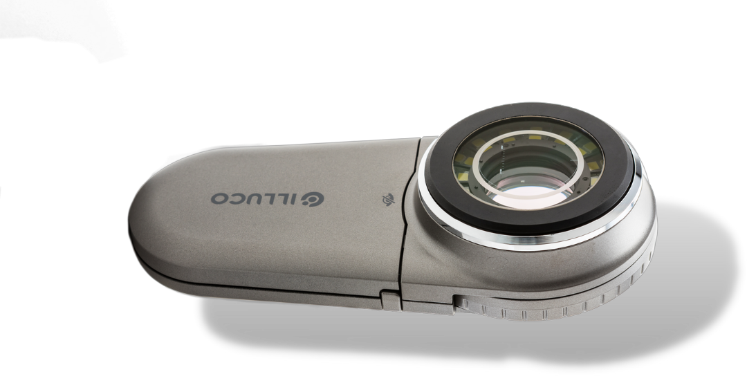 Hautkrebsvorsorge | Dermatoskopie Verfahren | Dermatoskope bei DermoScan